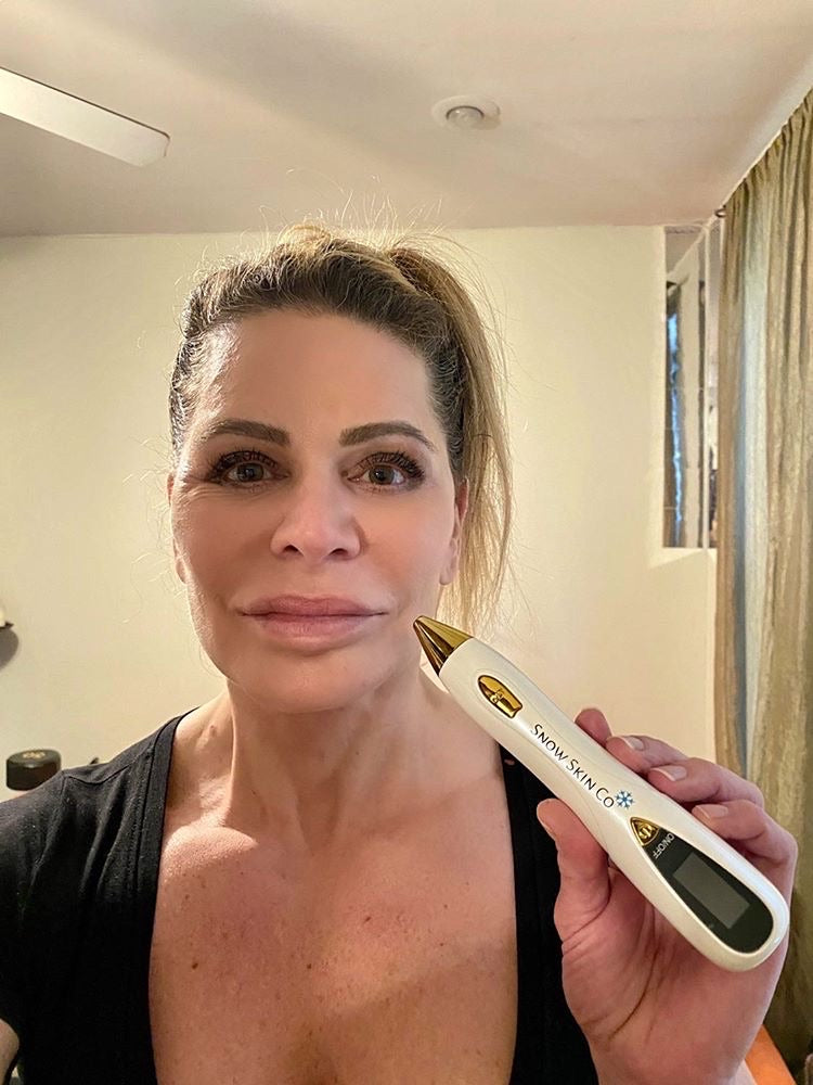 2x Snow Fibroblast Plasma Pens